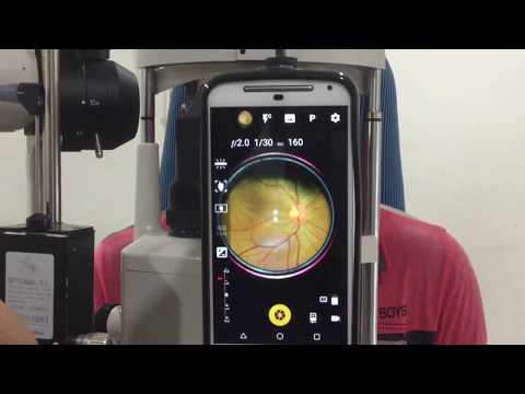 Fundus Camera - Retinal Camera Latest Price, Manufacturers & Suppliers