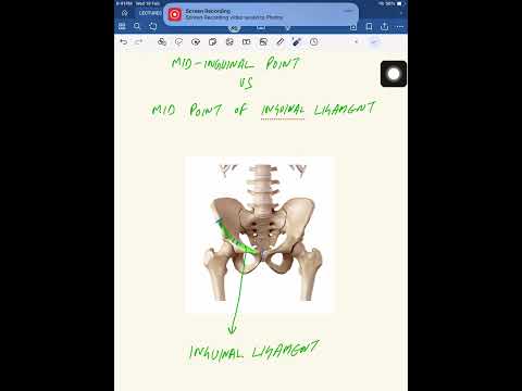MId Inguinal Point vs mid point of inguinal liagemnt