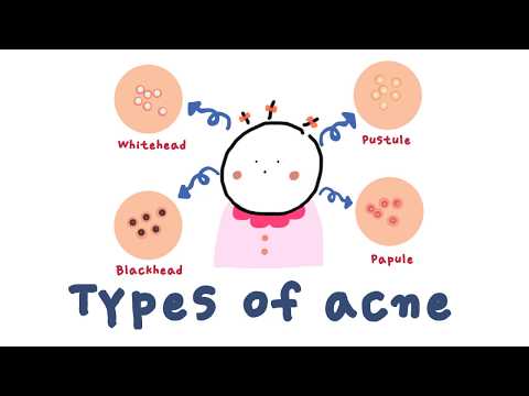 Healthy skin: different types of acne ? pustule? whitehead? blackhead? papule?