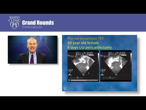 CV Grand Rounds – TEE Guided Cardioversion After Cardiac Surgery
