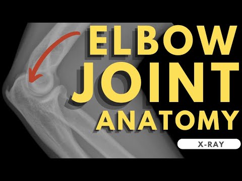 Elbow joint anatomy | Radiology anatomy part 1 prep | Elbow bones, alignment and fat pads on X-ray