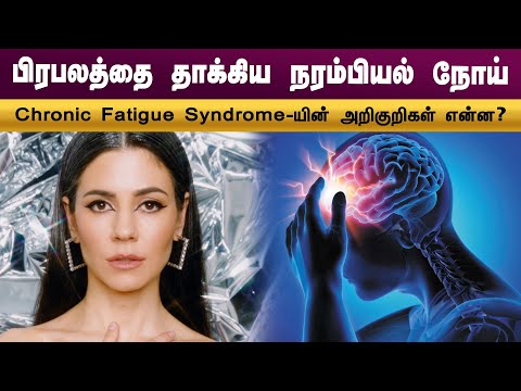 Chronic Fatigue Syndrome-ஆல் பிரபல பாடகி Marina Diamandis பாதிப்பு | Myalgic Encephalomyelitis