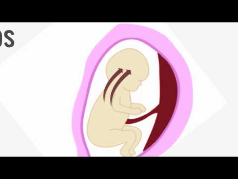 Topic 30: Postterm Pregnancy