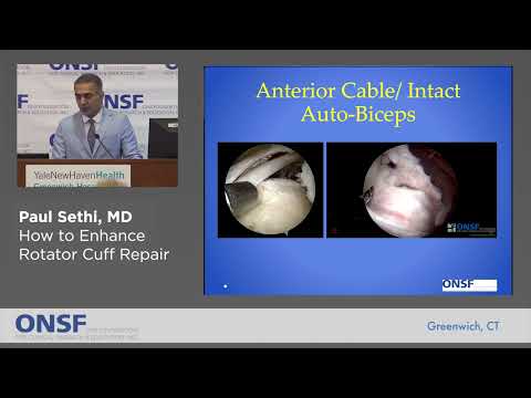 Paul Sethi, MD - How to Enhance Rotator Cuff Repair