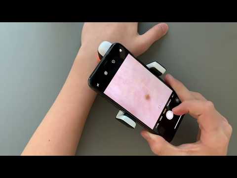 How to use DermLite HÜD to take photos of your skin lesions
