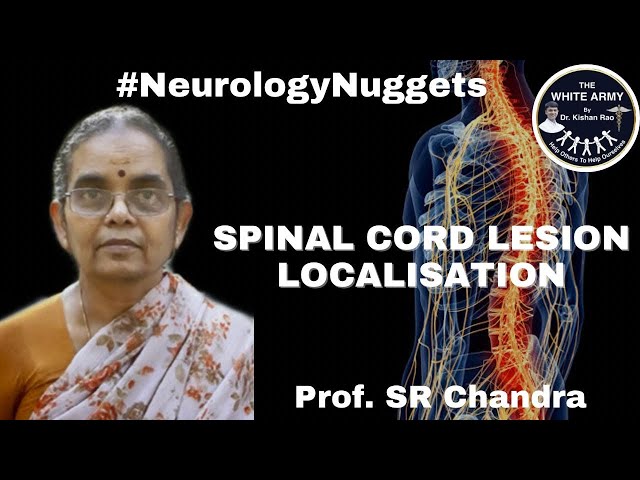 Understanding Spinal Cord Lesion Localization: Insights from Prof. S R ...
