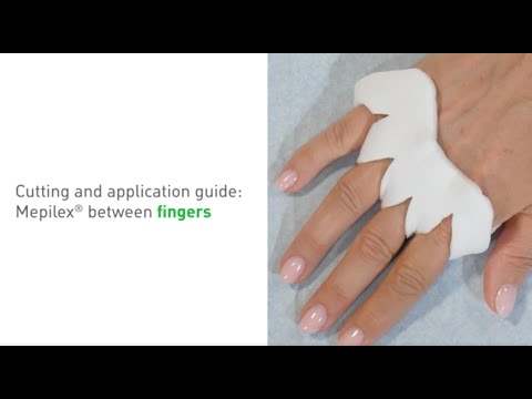 How to apply Mepilex between fingers