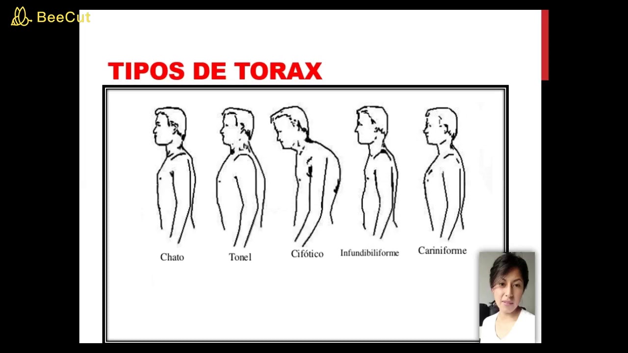 TIPOS DE TÓRAX