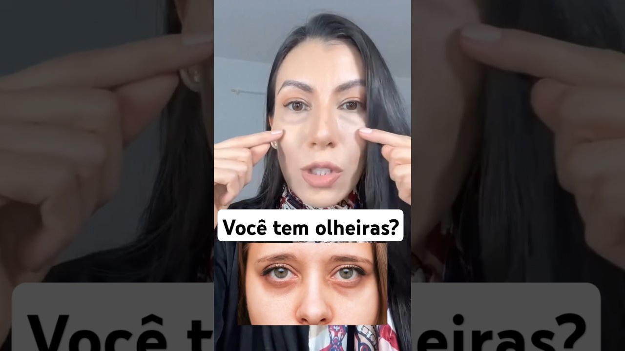 Está com olheiras? Olheiras escuras ou até bolsas embaixo dos olhos? #olheiras #beleza