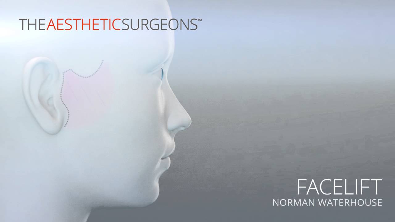 Facelift | The Aesthetic Surgeons™ | HD