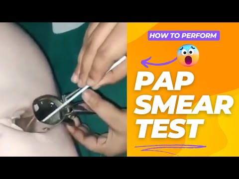 How to perform Pap smear test | Pap smear test in Hindi