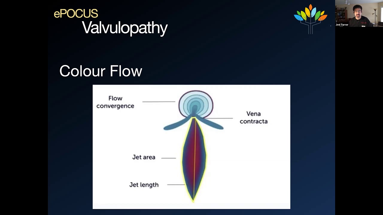 POCUS Series: Valves
