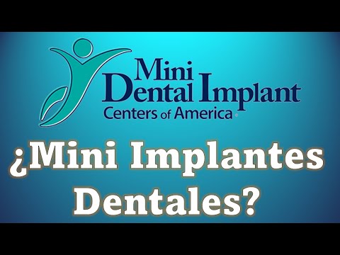 ACCESO TOTAL: Dr. Rodriguez Mini Implantes Dentales