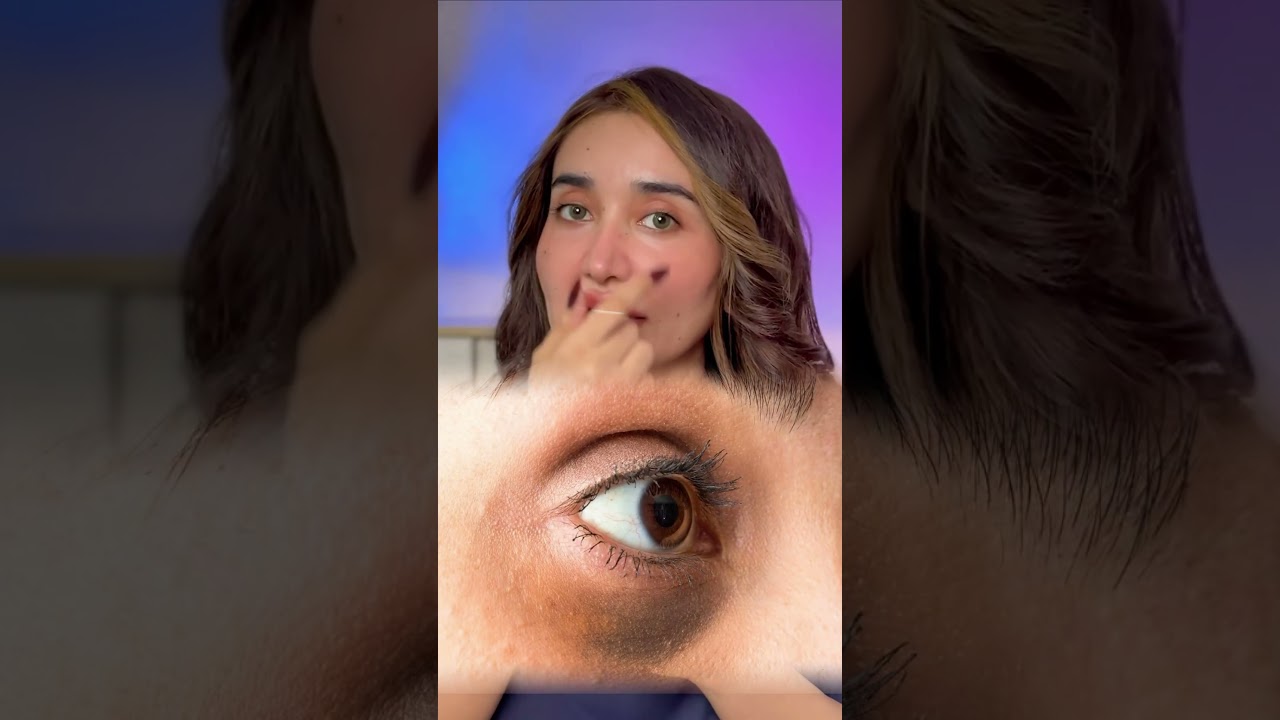 Types of dark circles! #pakistani #skincare #shorts