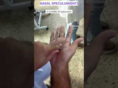 How to hold nasal speculum (ENT) .  #Ent #mbbs #medicalstudent #neet #ward