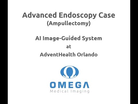 Advanced Endoscopy Case with AI Image-Guided System