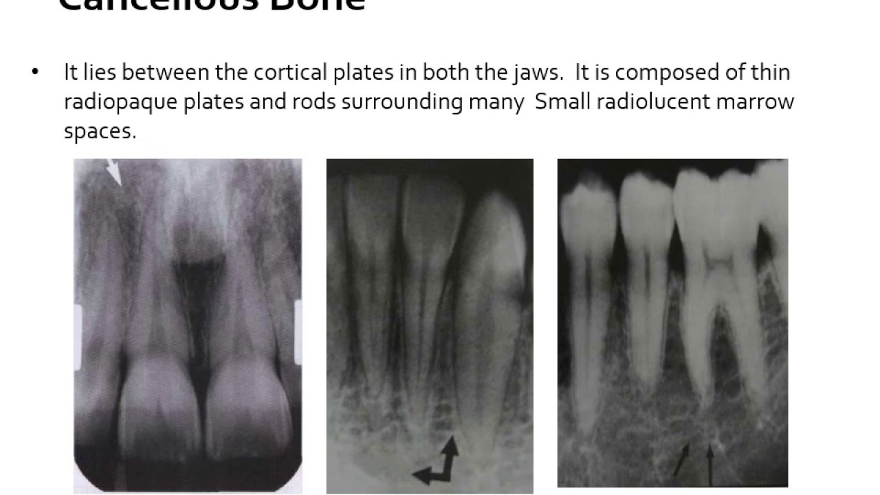 NORMAL  RADIOGRAPHIC  ANATOMICAL  LANDMARKS