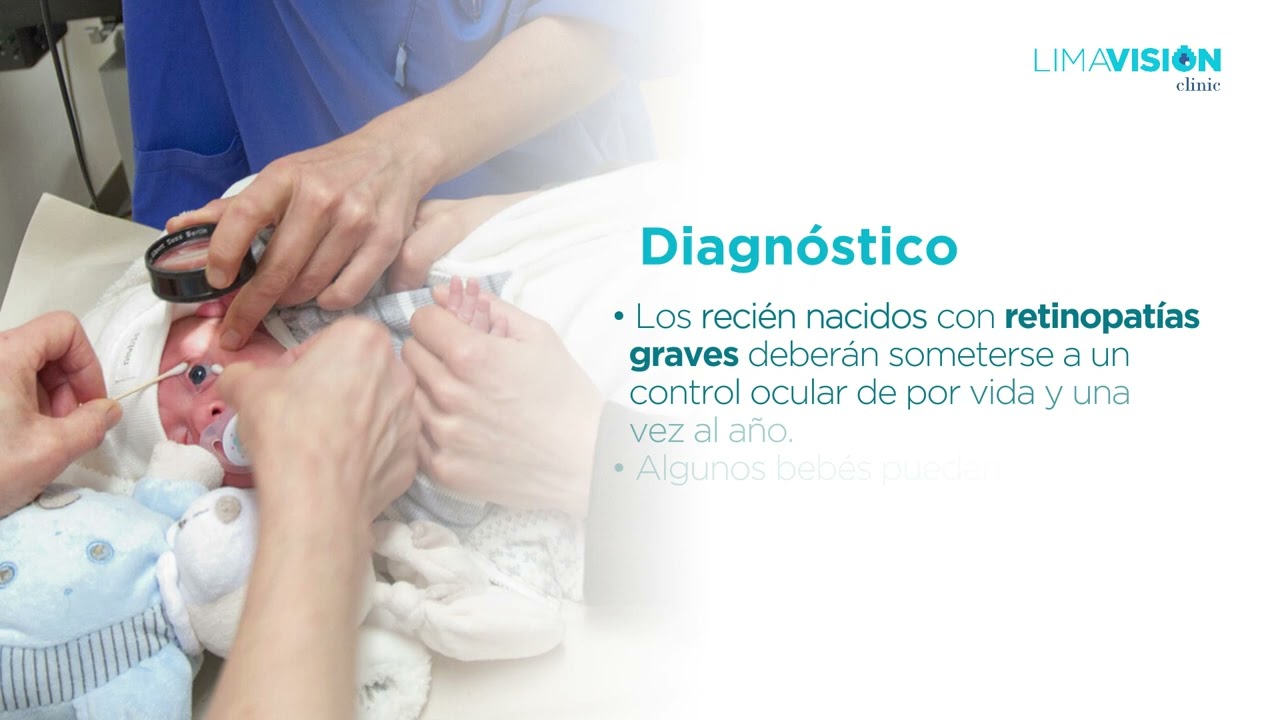 Retinopatía del prematuro