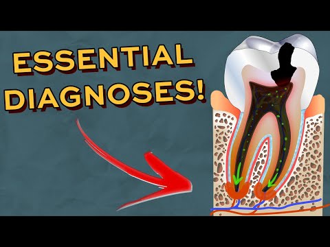 Why Shouldn'T You Drink Carbonated Beverages After Oral Surgery