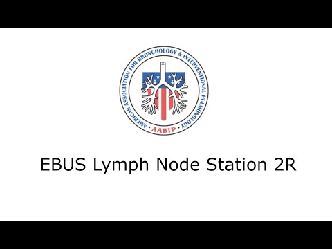 EBUS Lymph Node Station 2R