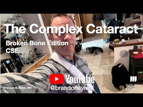 The Complex Cataract