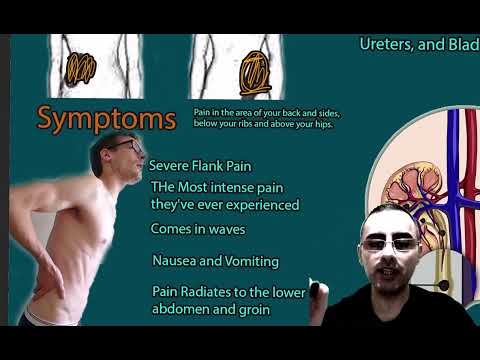 Renal Colic: Symptoms, causes and treatment