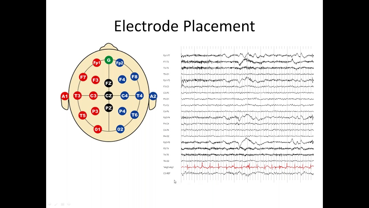 Understanding the EEG