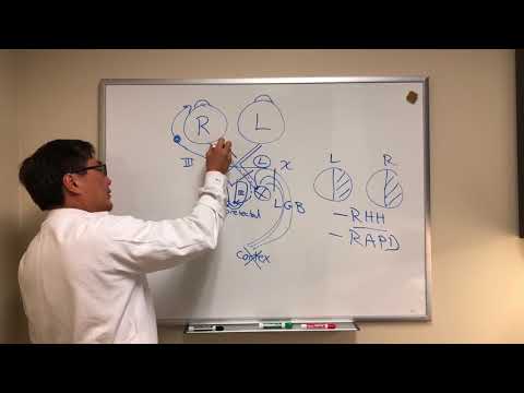 [VIDEO] Homonymous Hemianopia – YouTube | TBI Rehabilitation