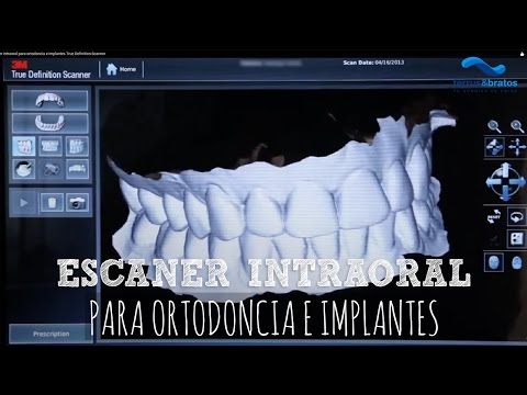 Escaner intraoral para ortodoncia e implantes True Definition Scanner