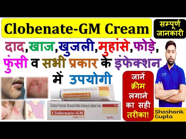 Clobetasol Propionate Cream - Clowin gm ointment Wholesaler from Lucknow
