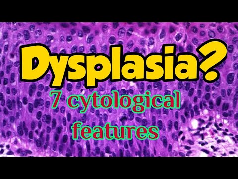 7cytological features of Dysplasia: Medschool Microvlog 8