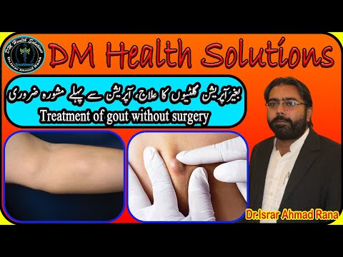 Lipoma ka ilaj | Lipoma Treatment in Urdu | Gilti ka ilaj in Hindi | #lipoma | #trendingnow | #duet