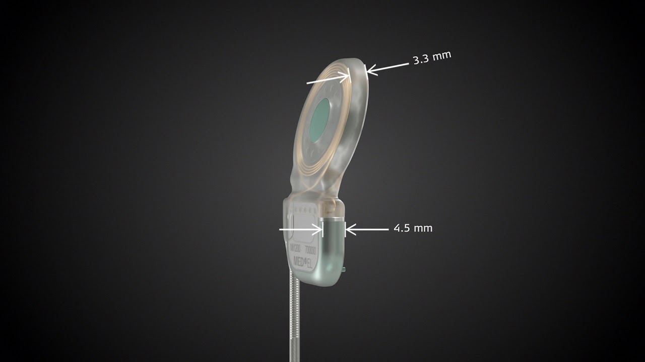 MRI and Cochlear Implants