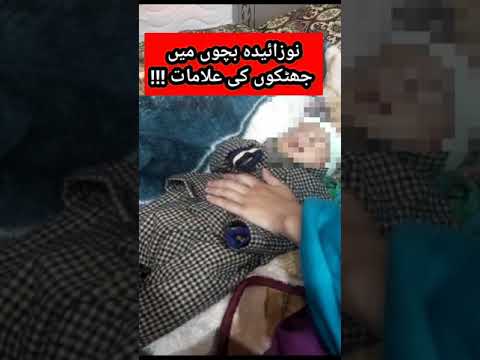 Bachon mn jhatkon ki ilamat - Fits,seizures and epilepsy- Signs,symptoms and treatment-Urdu hindi