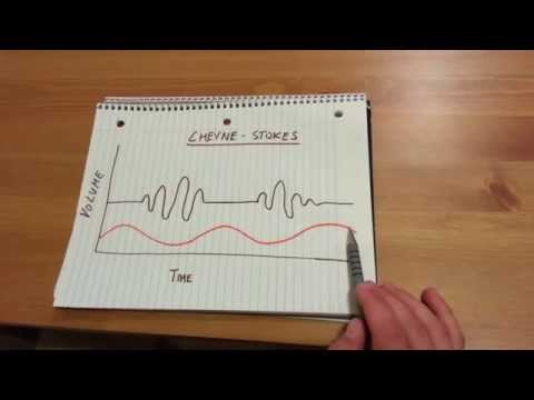 Cheyne-Stokes Respiration