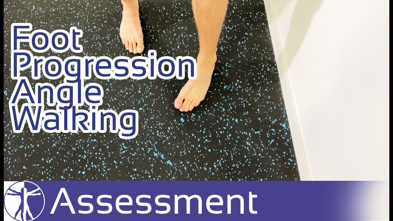 Foot Progression Angle Walking (FPAW) Test | FAI & Hip Instability