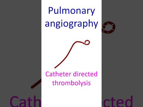 Pulmonary angiography