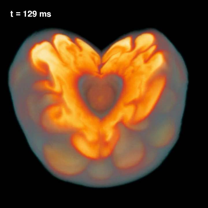 Supernova explosion: Computer simulation of the first 500 milliseconds