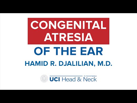 Congenital Atresia of the Ear by Dr. Hamid Djalilian - UCI Head & Neck