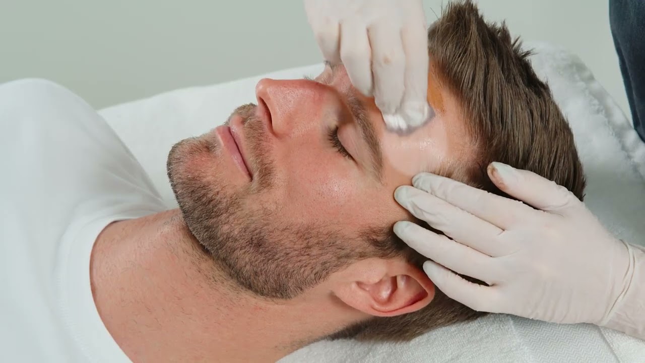 VI Peel Professional Treatments-- Process and Benefits!