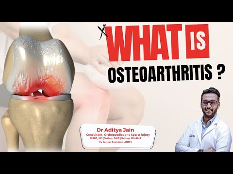 What is Osteoarthritis? Causes, Symptoms, and Treatment | Dr. Aditya Jain