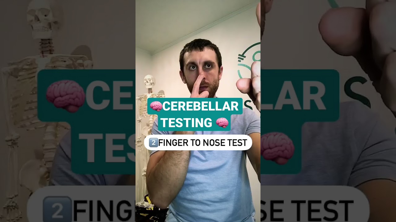 🧠Cerebellar (Coordination) Testing #shorts