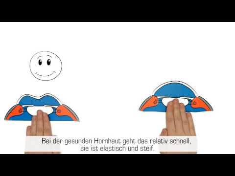 Corneale Biomechanik – Erklär-Video in Deutsch (mit Untertiteln)