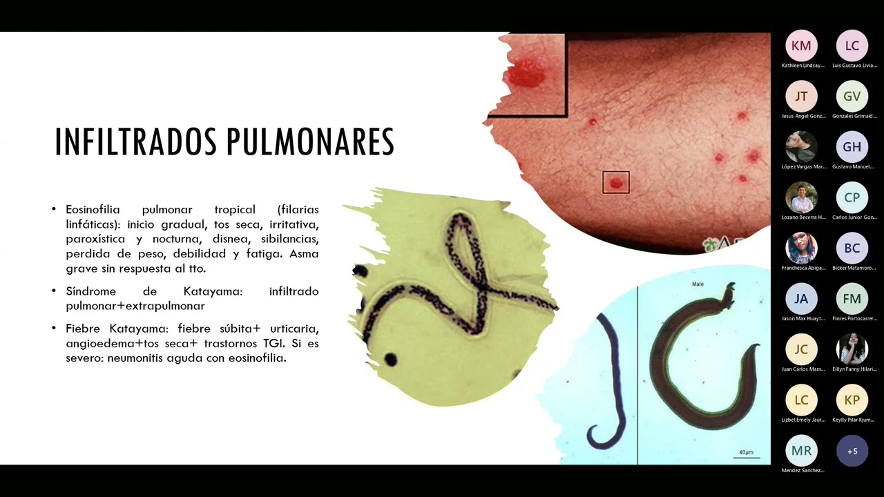 Parasitosis y micosis pulmonar