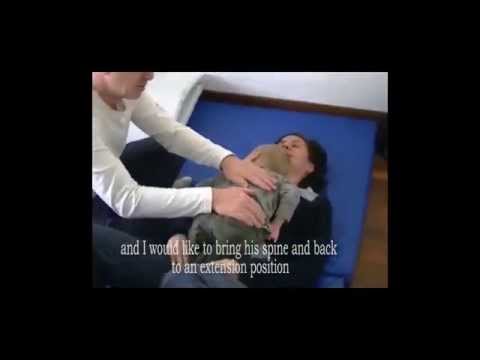 Wolf-Hirschhorn syndrome – FRANCESCA SEEGY