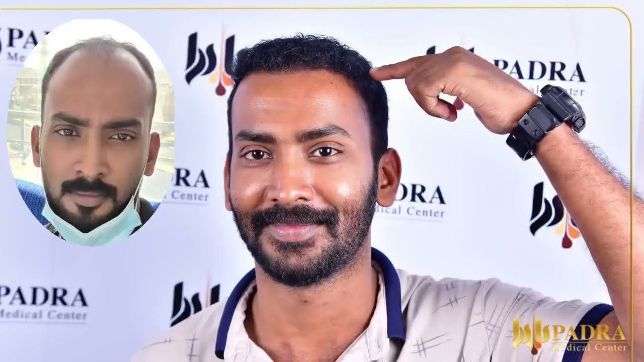 Padra – Padra Medical Center Hair Transplant in Dubai