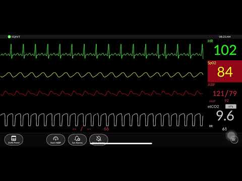 Simulated Patient Monitor
