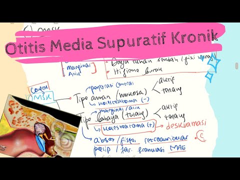 2. Otitis Media Supuratif Kronik (OMSK) : Patogenesis, Klasifikasi, Tatalaksana dll.