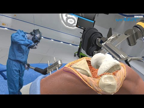 Steam Community :: Video :: WRAITH Total Knee Surgery Simulation - not ...
