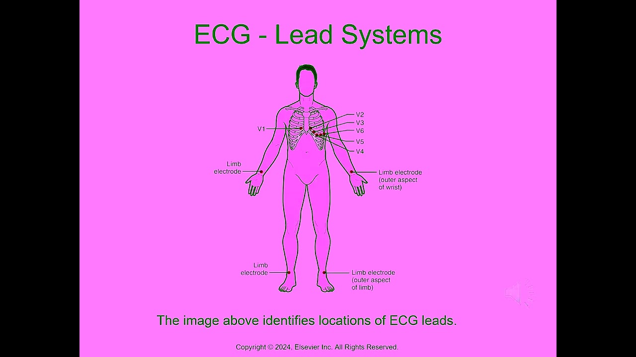 Chapter 28 Concepts of Care for Patients with Dysrhythmias